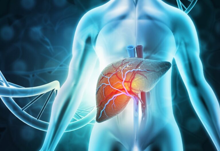 Understanding Fat and Scars in Fatty Liver Disease